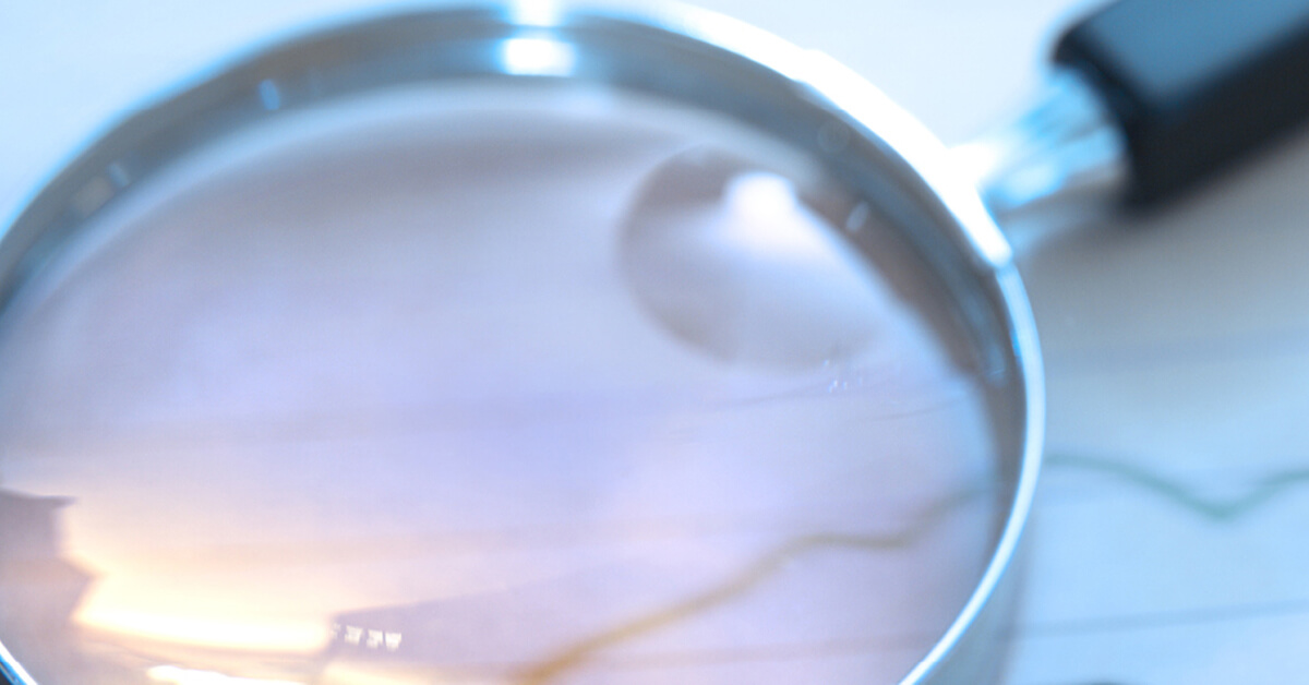 Pulling Off the Band-Aid, Going Overweight Small Cap | RBCCM